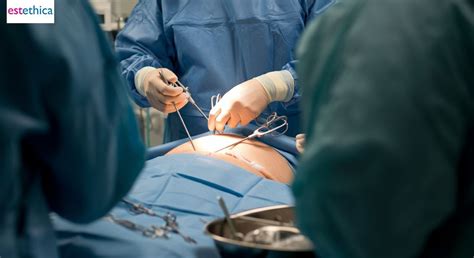 Mastering Bariatric Surgery Essential Insights