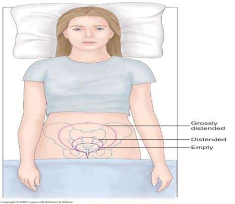 Diagnosis Lab 2 O Flashcards Quizlet