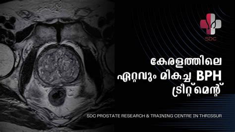 Bph Treatment Options In Kerala