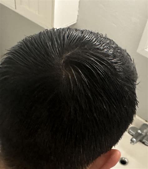 Counterclockwise Or Clockwise Crown R Malehairadvice