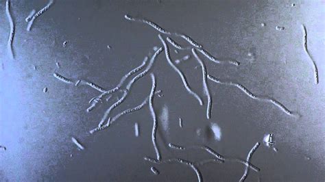 Bacilli Bacteria Microscope