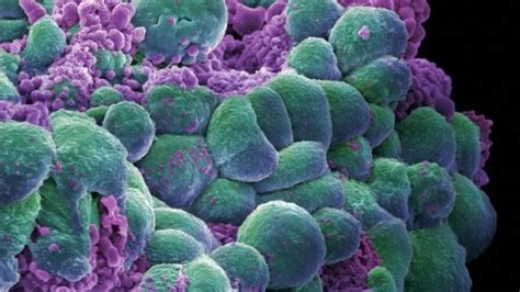 Създадоха ново лекарство срещу рак