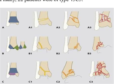 Figure 1 From External Fixator Supplemented With Screw Fixation Versus Staged External Fixator