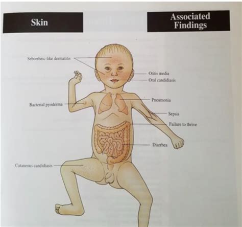 Module 20 Genodermatoses 2 Flashcards Quizlet