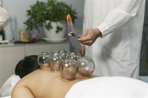 Cupping Therapy Physioedge Physiotherapy Clinics Goa