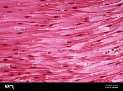 What Does Smooth Muscle Look Like Under A Microscope