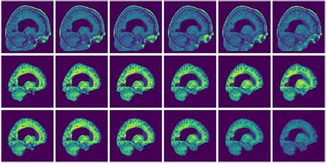 selected mri slices ibsr data set sagittal mri plane segmented