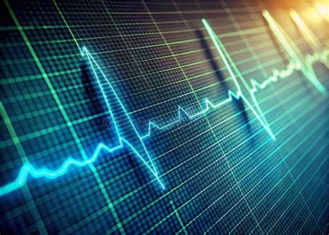 Understanding Heart Rate Variability And Ekg Patterns A Comprehensive