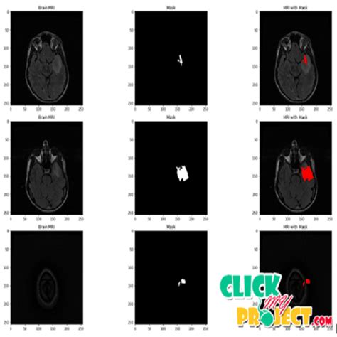 Application And Construction Of Deep Learning Networks In Medical