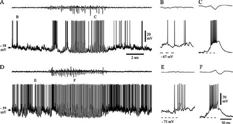 Intracellularly Recorded Activity Of Nrt Neurons During Swds A The