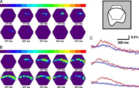 Neostigmine Enhances Gaba Waves In Rat Prefrontal Cortex A And B Download Scientific Diagram