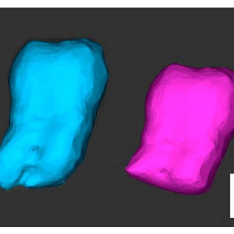 A B Segmentation Of The Tooth Transplant Blue C Segmented Donor Download Scientific
