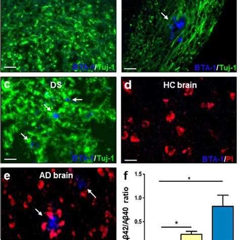 Characterization Of Aβ Deposition By Staining With An Amyloid Binding