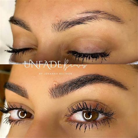 Microblading Over Scars Is It Safe For Everyone
