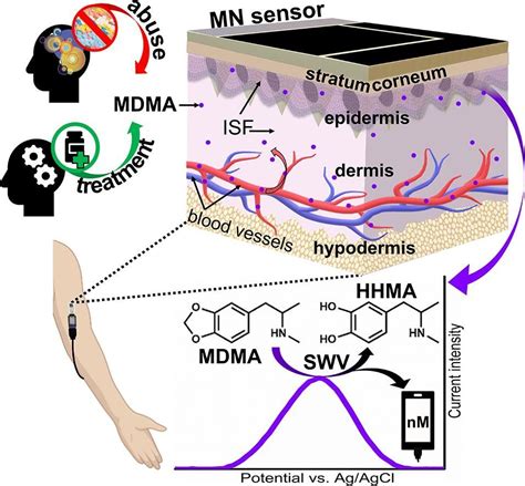 On Linkedin Microneedle Array Based Electrochemical Sensor Functionalized