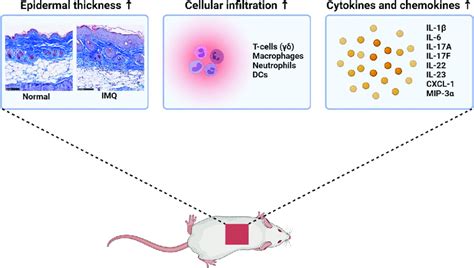 Characteristics Of Imq Induced Skin Inflammation In Wild Type Mice