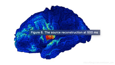Mne溯源fieldtrip官网教程 Csdn博客