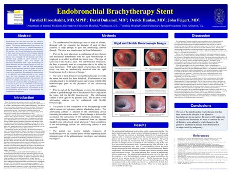 Ppt Endobronchial Brachytherapy Stent Powerpoint Presentation Free