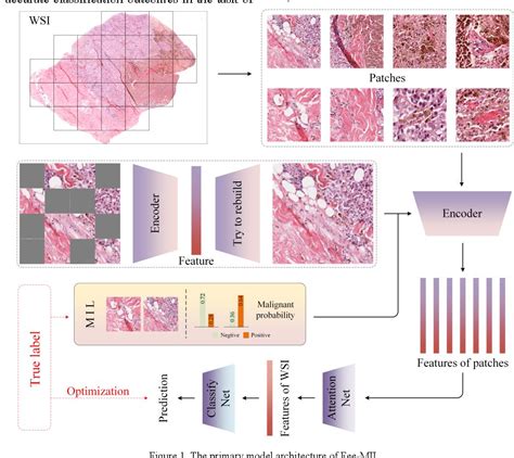 Figure 1 From A Computer Aided Diagnosis System Based On Feature Extraction Enhanced Multiple