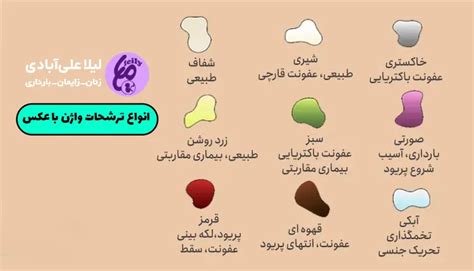 انواع ترشحات واژن با عکسترشحات آبکی واژن نشانه چیستلیلا علی آبادی