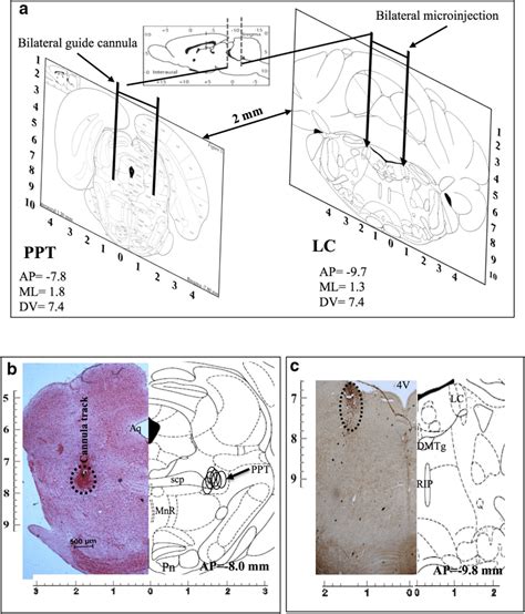 A Diagrammatic Representation Of Rat Brain Atlas Sections Through PPT Download Scientific