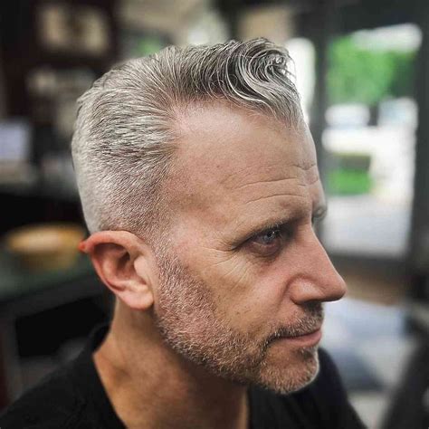 Thinning Hair Front Men