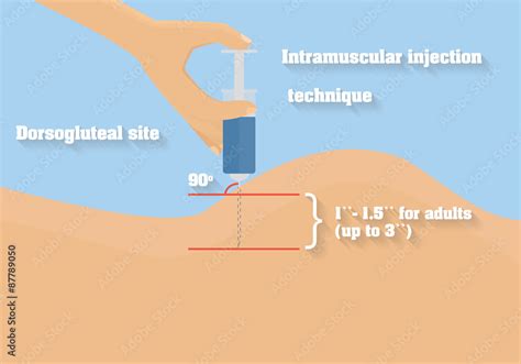 Intramuscular Injection