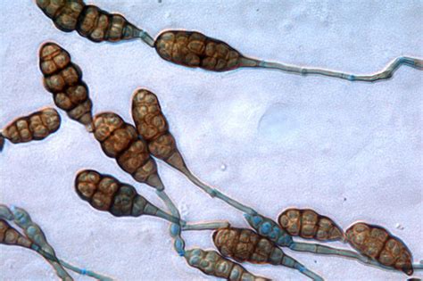 ალტერნარია Alternaria ალერგოლოგიური პროგნოზი Vidal Ge