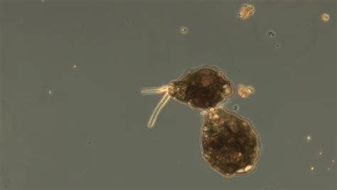 Light Microscope Footage Of Difflugia Pyriformis Testate Amoeba