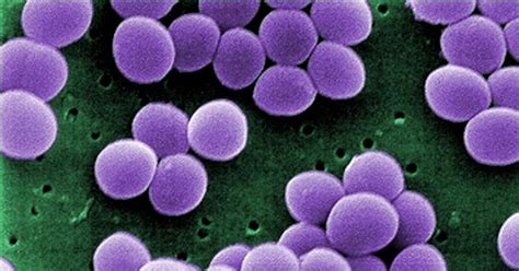 New Agent Inhibits Staphylococcus Aureus Toxin Hope For Pneumonia Patients News The