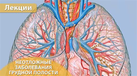 Часть 1 КТ при неотложных заболеваниях органов грудной полости Андрей Мангов Youtube