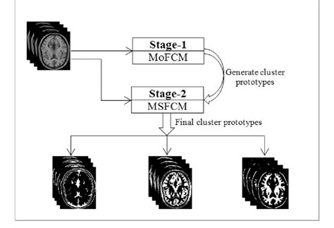 The Complete Work Flow Of The Proposed Two Stage 3d Image Segmentation