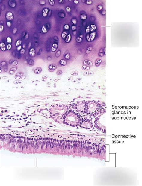 Microscopic Veiw Of Trachea Diagram Quizlet