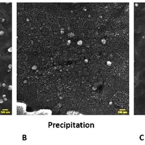 Total Protein Content After Exosome Isolation Methods By Different Download Scientific Diagram