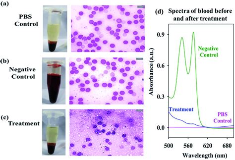 Pictorial Diagram For The Hemolysis Assay For A Pbs Control B Download Scientific Diagram
