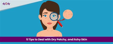 5 Tips To Deal With Dry Patchy And Itchy Skin Wow Health Pakistan