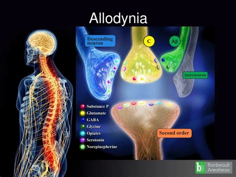 Ppt Opioid Free Anesthesia Powerpoint Presentation Free Download