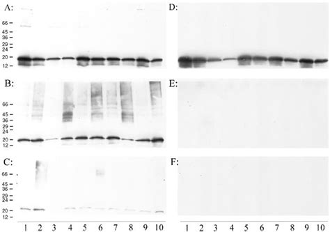 Widespread Alterations Of α Synuclein In Multiple System Atrophy Pmc