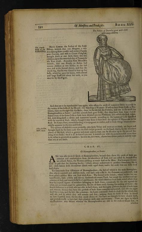 The Works Of That Famous Chirurgeon Ambrose Parey Paré Ambroise