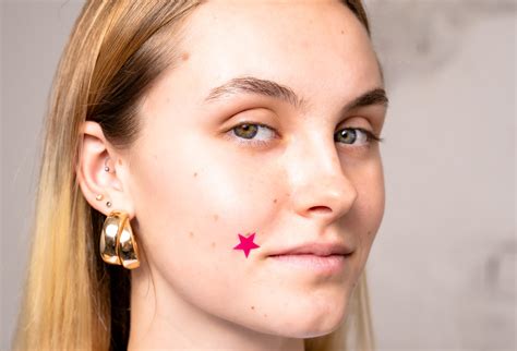 How To Correctly Use A Pimple Patch For Breakouts