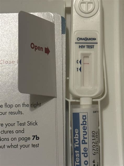 She Had A Negative Hiv Test After We Had Sex The Next Day I Got On Pep But She Had Sex Two Weeks