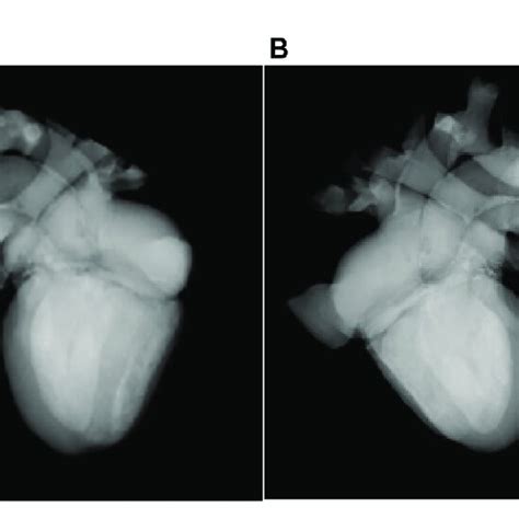 Rendering Of The Biological Structure Of The Heart A Rendering