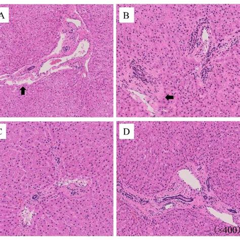 Schematic Diagram Of The Experimental Liver Graft 1 In The First