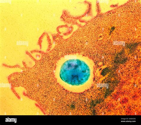 Macrophage Eating Clostridium Bacterium Coloured Transmission Electron Micrograph Tem Of A