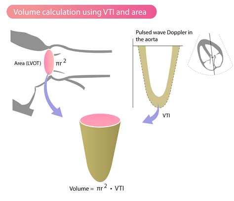 Stroke Volume Vti Velocity Time Integral And Cardiac Output The