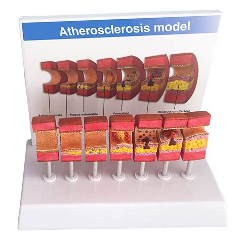 Professional Educational Model Artery Anatomical Model Anatomical