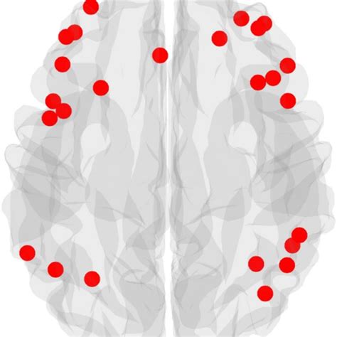 Frontoparietal Nodes The Frontoparietal System Consisted Of 25 Download Scientific Diagram