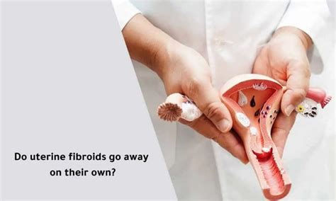 Understanding Endometriosis And Uterine Fibroids London Fibroid Clinic