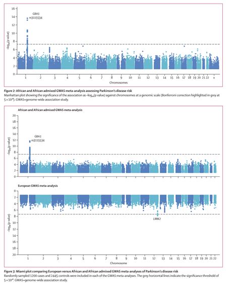 Lancet Neurol—13以上的非洲裔帕金森病患者都可能携带致病基因gba1 Rs3115534帕金森基因 健康界