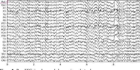 Figure 2 From Designing An Embedded Feature Selection Algorithm For A